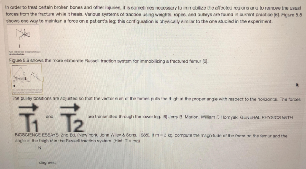 Solved Figure 55: A simple traction scheme. Like the | Chegg.com