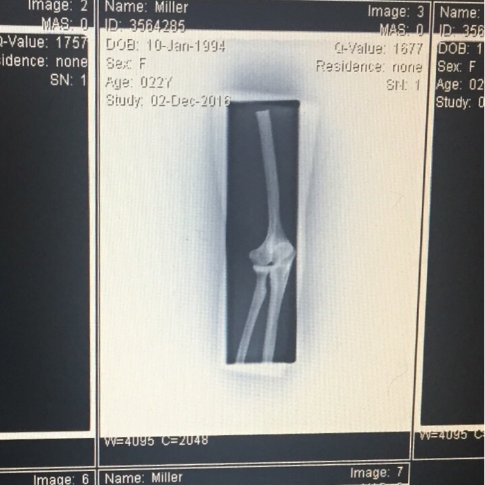 Solved (Radiologic questions)Compare the two images and | Chegg.com