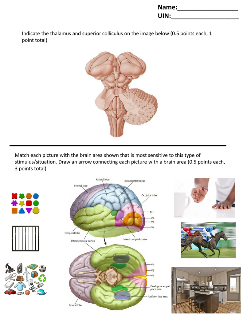 Solved Indicate the thalamus and superior colliculus on the | Chegg.com