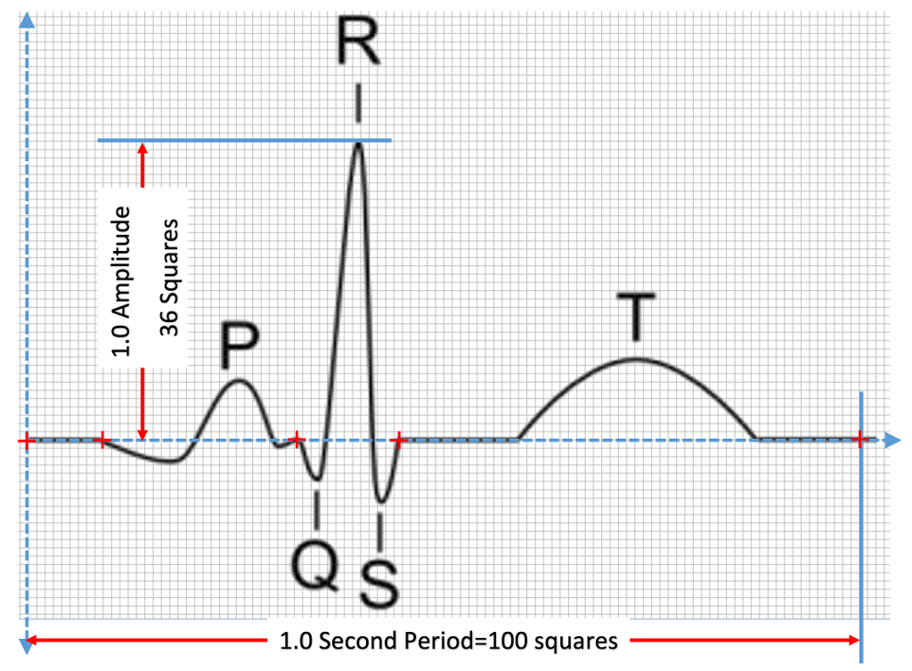 Simulating EKG with Fourier Series Students will | Chegg.com