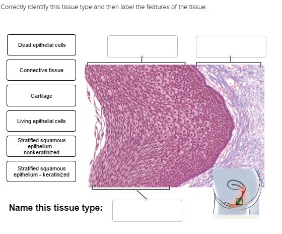 Solved Correctly identify this tissue type and then label | Chegg.com