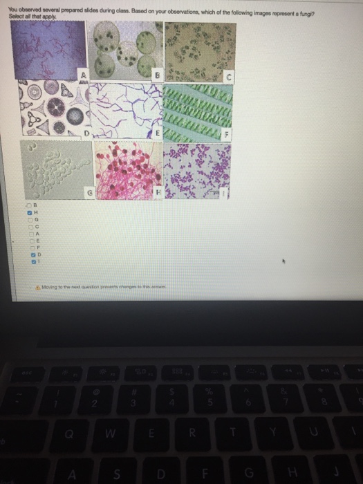 Solved You observed several prepared slides during class. | Chegg.com