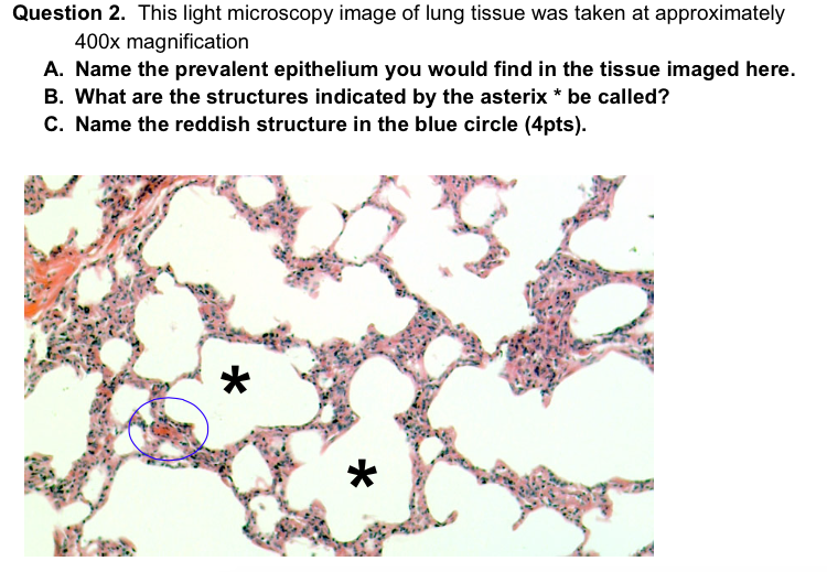 Solved This light microscopy image of lung tissue was taken | Chegg.com
