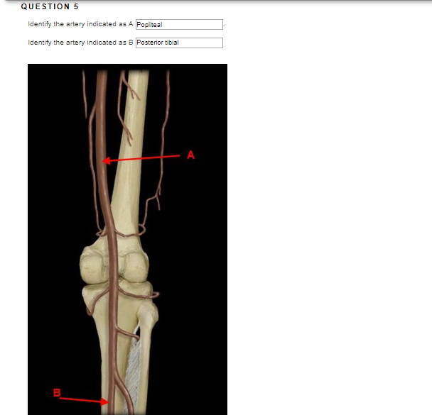 Solved QUESTION 1 Identify the artery indicated as A | Chegg.com