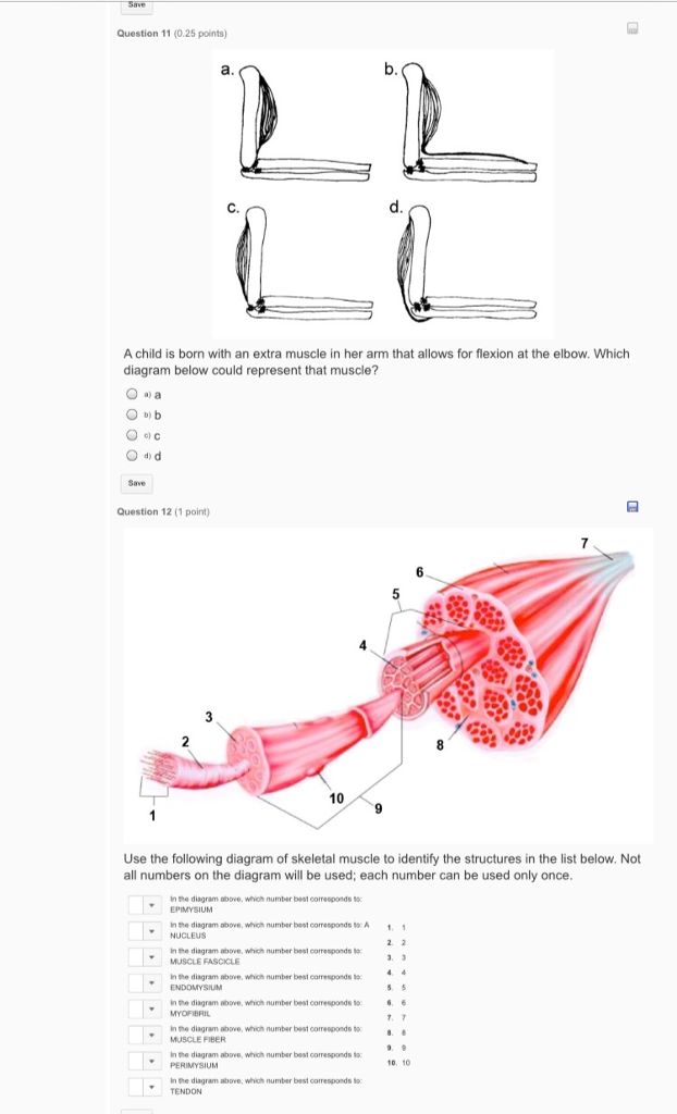 Solved Question 11 (0.25 points) A child is born with an | Chegg.com