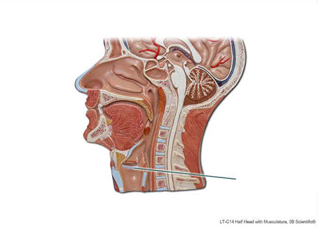 Solved Which structure is highlighted? vocal fold | Chegg.com