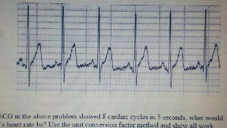 Solved this figure is an ECG made during a 10 second period. | Chegg.com