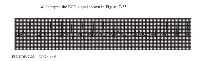 Solved Interpret the ECG signal shown in Figure. | Chegg.com