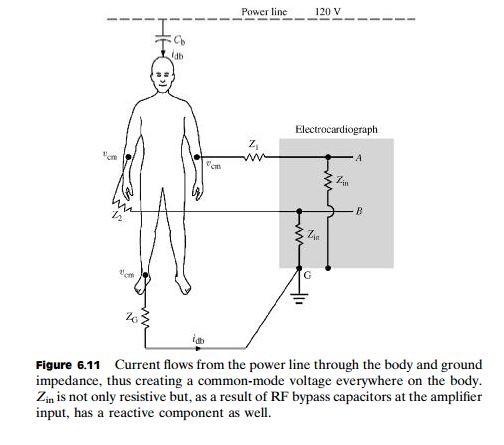 A student attempts to measure his own ECG on an | Chegg.com