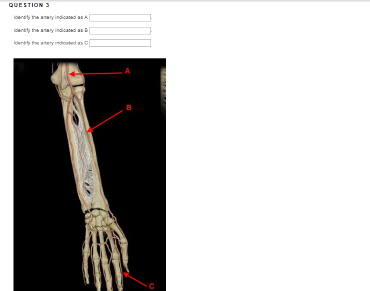 Solved Identify the artery indicated as A Identify the | Chegg.com Solved Identify the artery indicated as A Identify the | Chegg.com