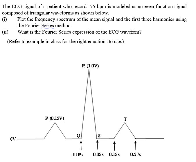 Solved The ECG signal of a patient who records 75 bpm is | Chegg.com
