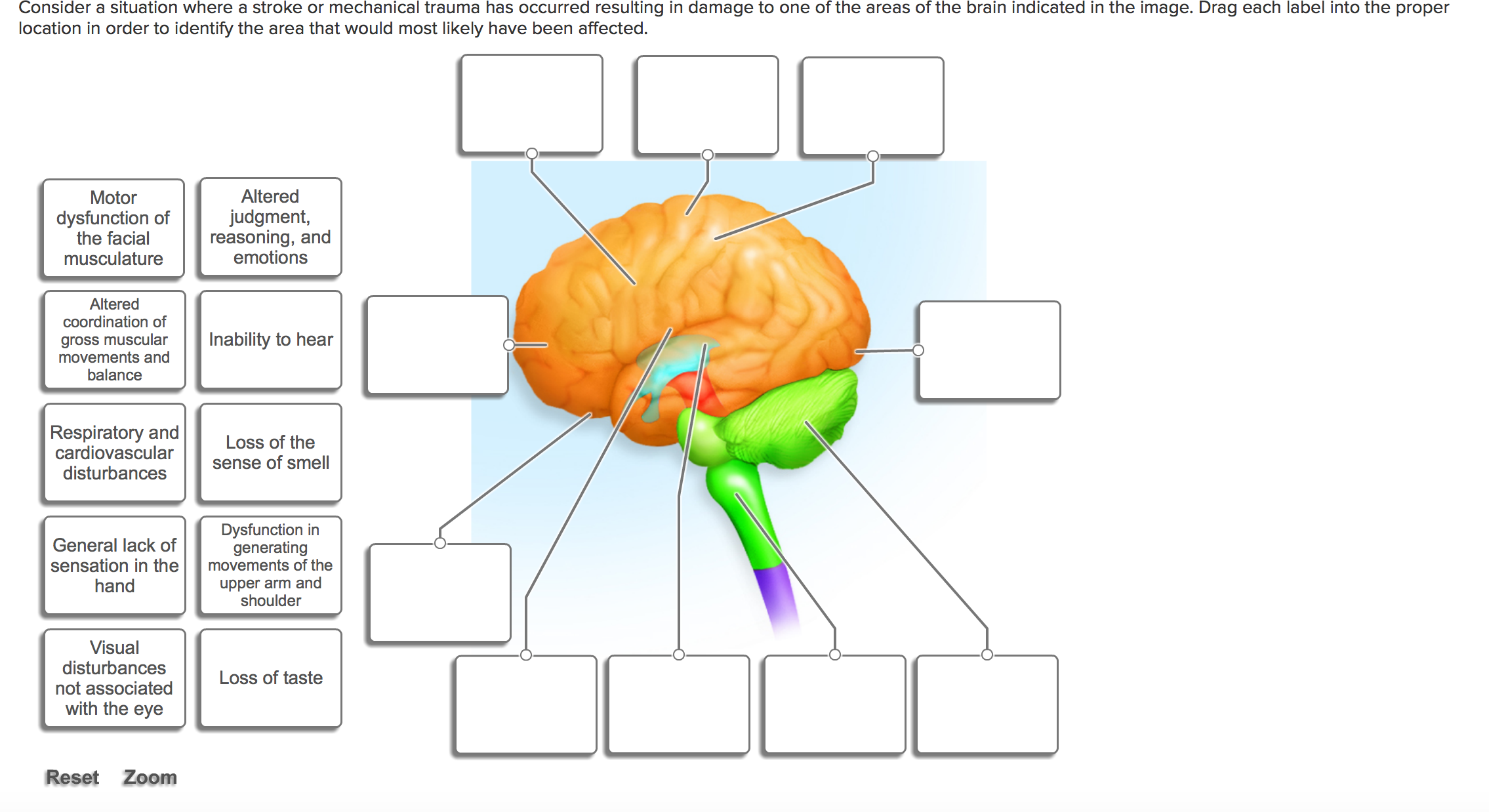 Solved Consider a situation where a stroke or mechanical | Chegg.com