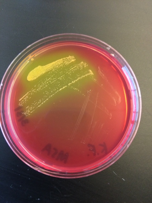 Solved Microbiology question. In lab, I was given three | Chegg.com