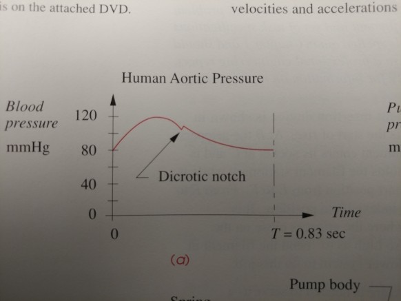A cam-driven pump to simulate human aortic pressure | Chegg.com