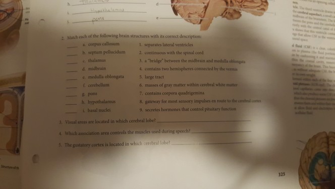 Solved Match each of the following brain structures with its | Chegg.com