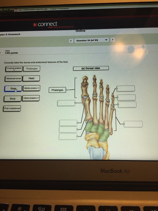 solved-correctly-label-the-bones-and-anatomical-features-of-chegg