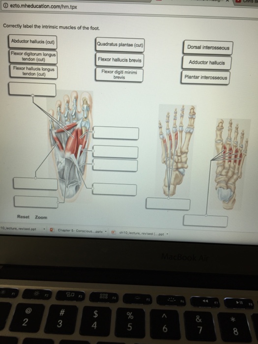 Solved Correctly label the intrinsic muscles of the foot. | Chegg.com