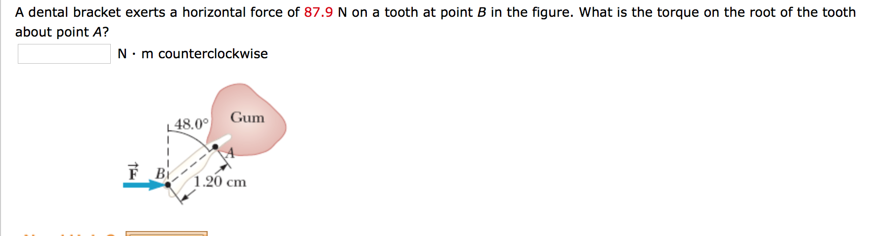 Solved A dental bracket exerts a horizontal force of 87.9 N | Chegg.com
