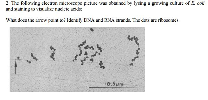 Solved The following electron microscope picture was | Chegg.com