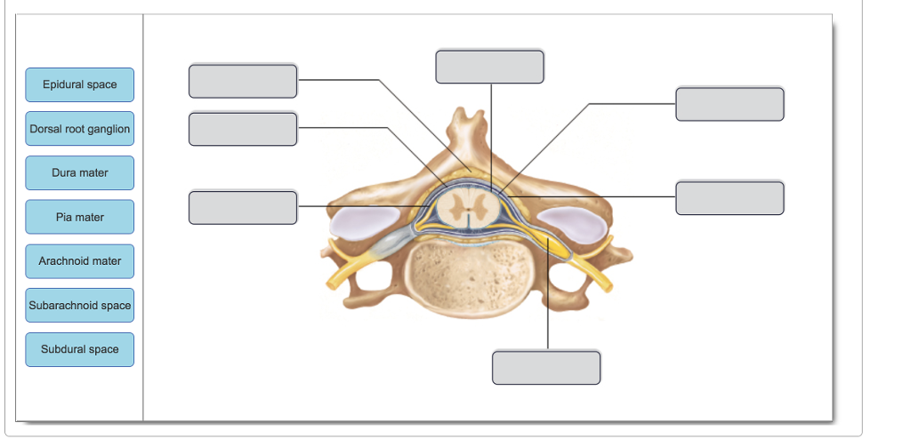 Solved Epidural space Dorsal root ganglion Dura mater Pia | Chegg.com