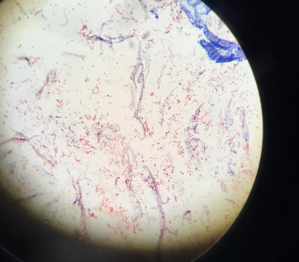 Solved i am trying to figure out my unknown bacteria. these | Chegg.com