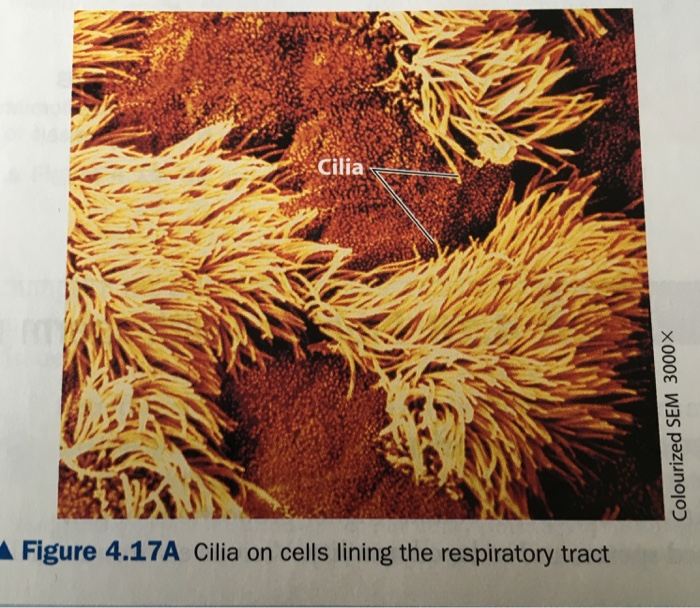 Solved This is the structure of cilia on the surface of a | Chegg.com
