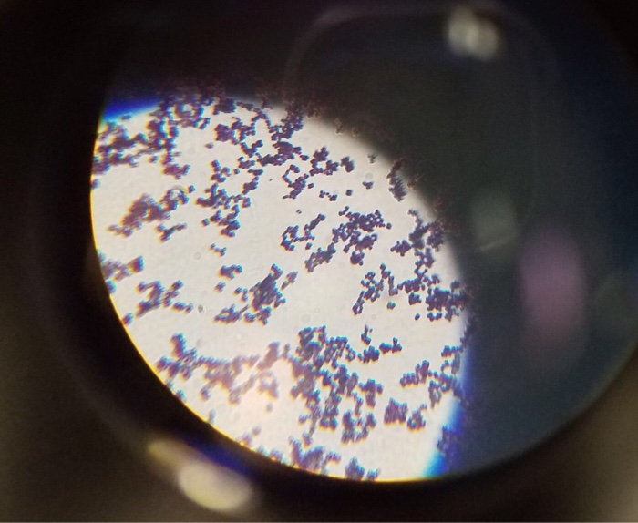 Solved By looking of the formation of this gram stain, is | Chegg.com