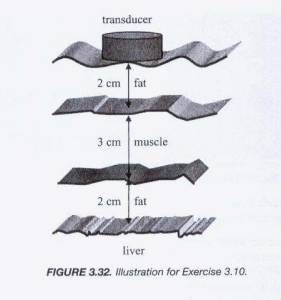 Use the following data to sketch the A-mode scan from | Chegg.com