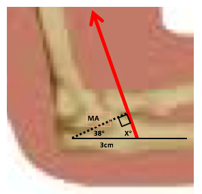 Calculate the length of the moment arm (MA, the | Chegg.com