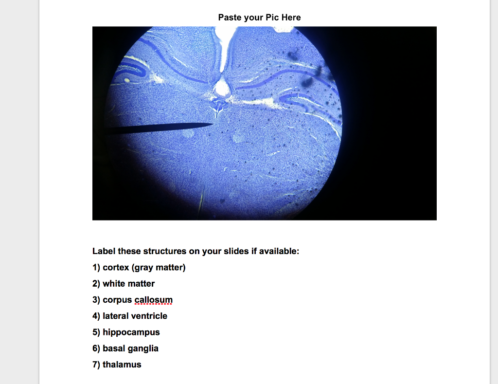 Solved Label these structures on your slides if available: | Chegg.com