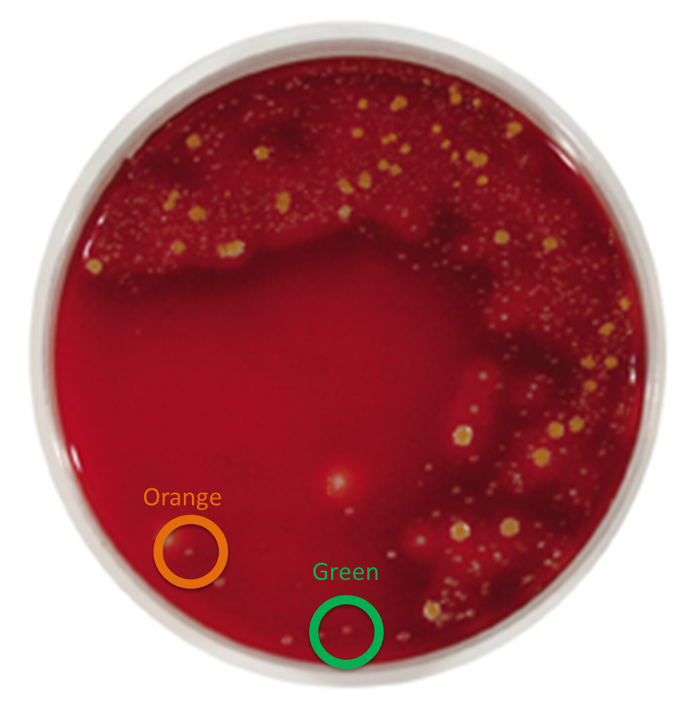 Solved The colonies grew after incubation, and the plate | Chegg.com