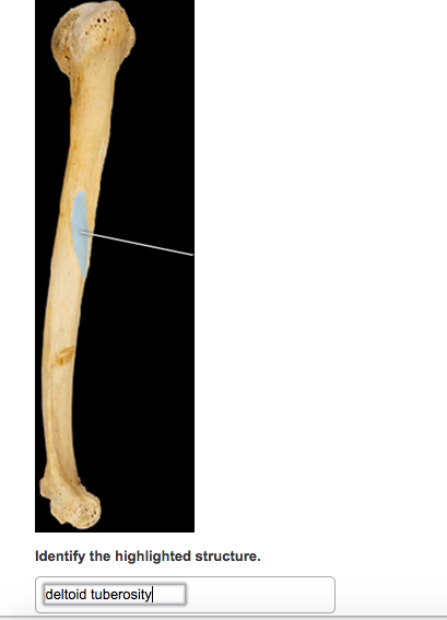 Solved Identify the highlighted structure. deltoid | Chegg.com
