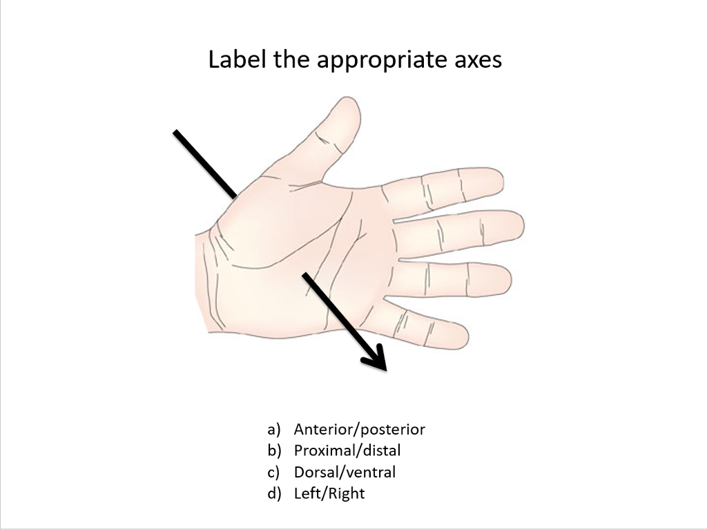 Solved Label the appropriate axes a) Anterior/posterior b) | Chegg.com
