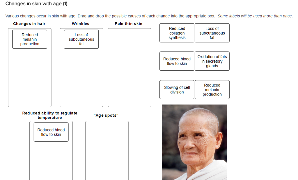 Solved Various changes occur in skin with age Drag and drop | Chegg.com