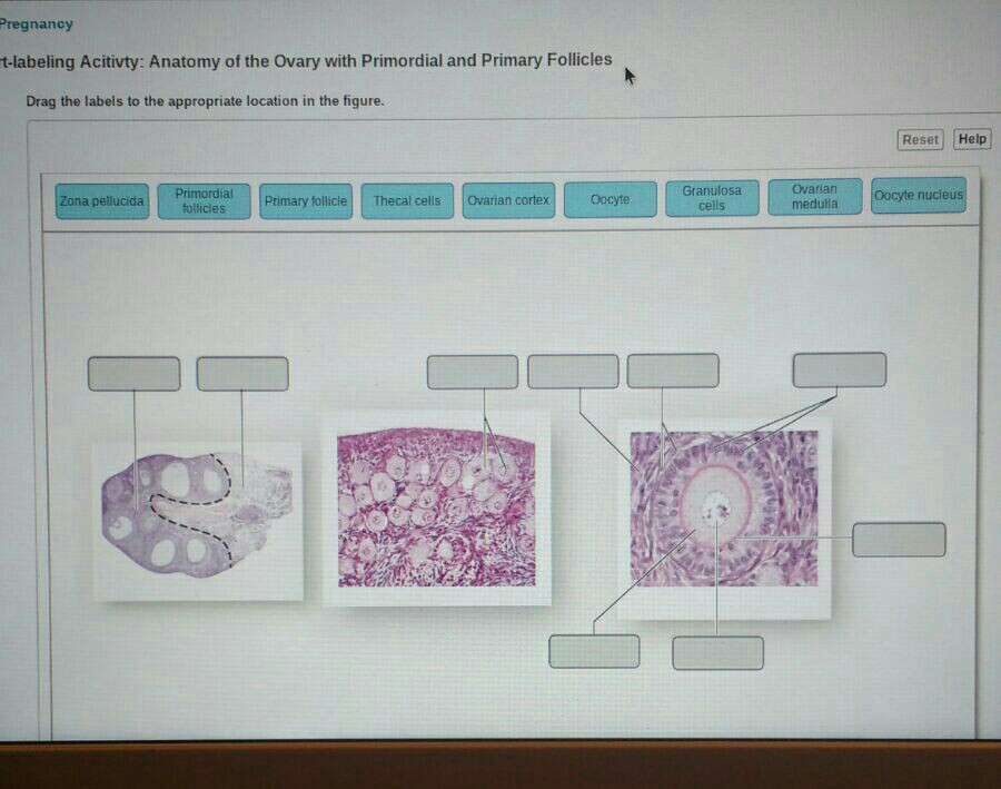 Solved Pregnancy t-labeling Acitivty: Anatomy of the Ovary | Chegg.com