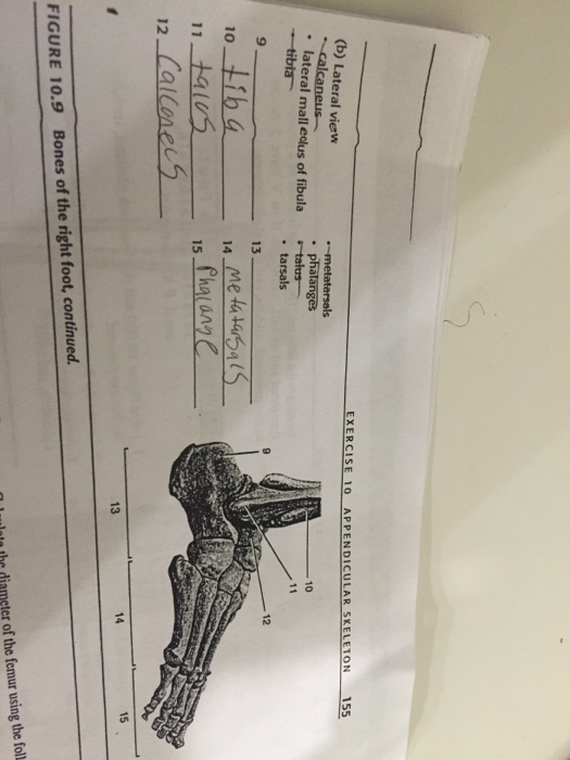 Solved EXERCISE 10 APPENDICULAR SKELETON 155 (b) Lateral | Chegg.com