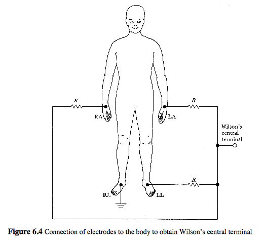 Solved Discuss the factors that enter into choosing a | Chegg.com