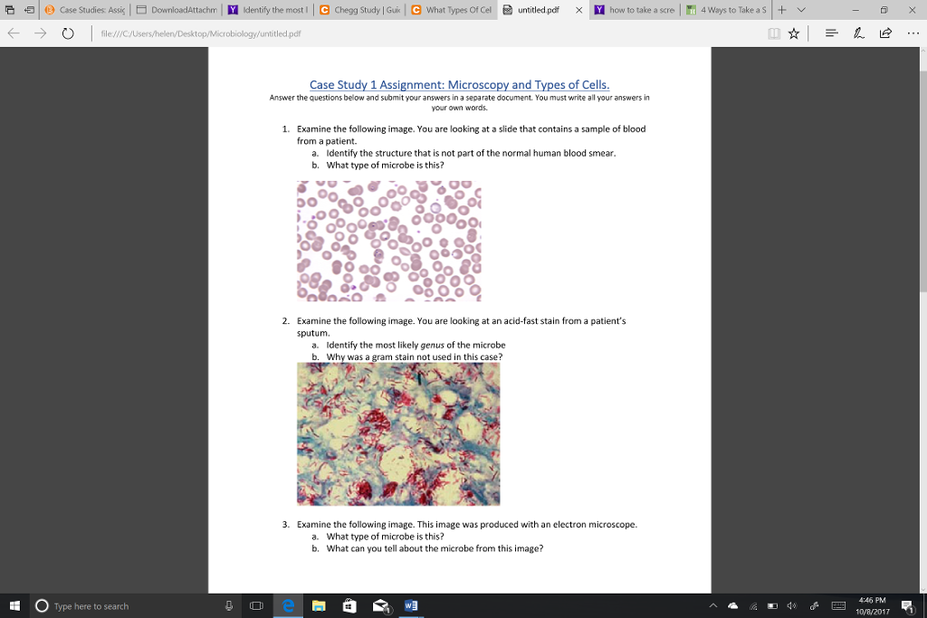 Solved case Studies Assis l M Identify the most l e Chegg | Chegg.com