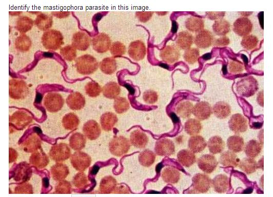 Solved Identify the mastigophora parasite in this image. | Chegg.com