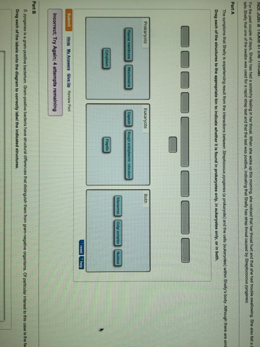 Solved The symptoms that Shelly is experiencing result from | Chegg.com Solved The symptoms that Shelly is experiencing result from | Chegg.com