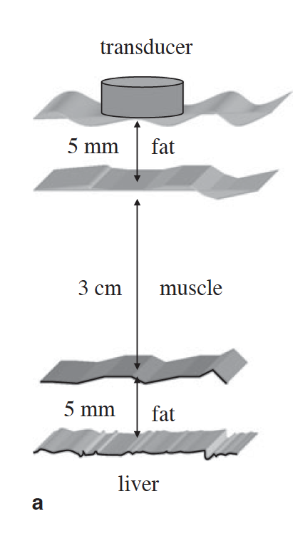Use the following data to sketch the A-mode scan from | Chegg.com