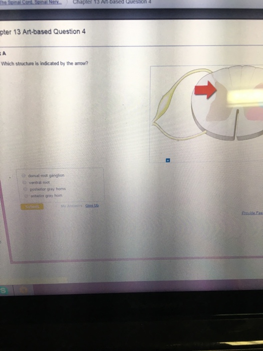 Solved Which structure is indicated by the arrow? | Chegg.com
