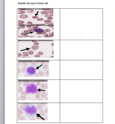 Solved identify the type of blood cell | Chegg.com