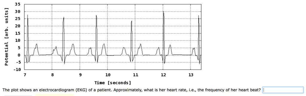 Solved The plot shows an electrocardiogram (EKG) of a | Chegg.com