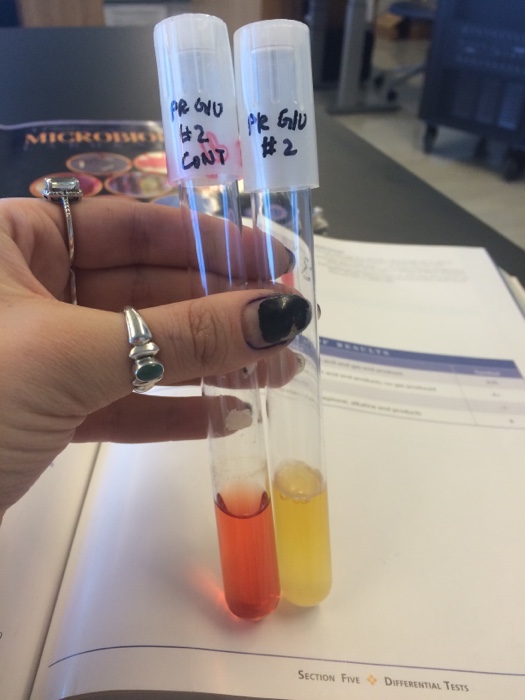 Solved PR Glucose results. Control is on the left and | Chegg.com