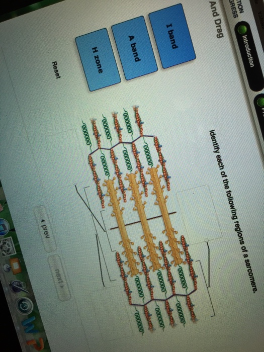 Solved Identify each of the following regions of a | Chegg.com