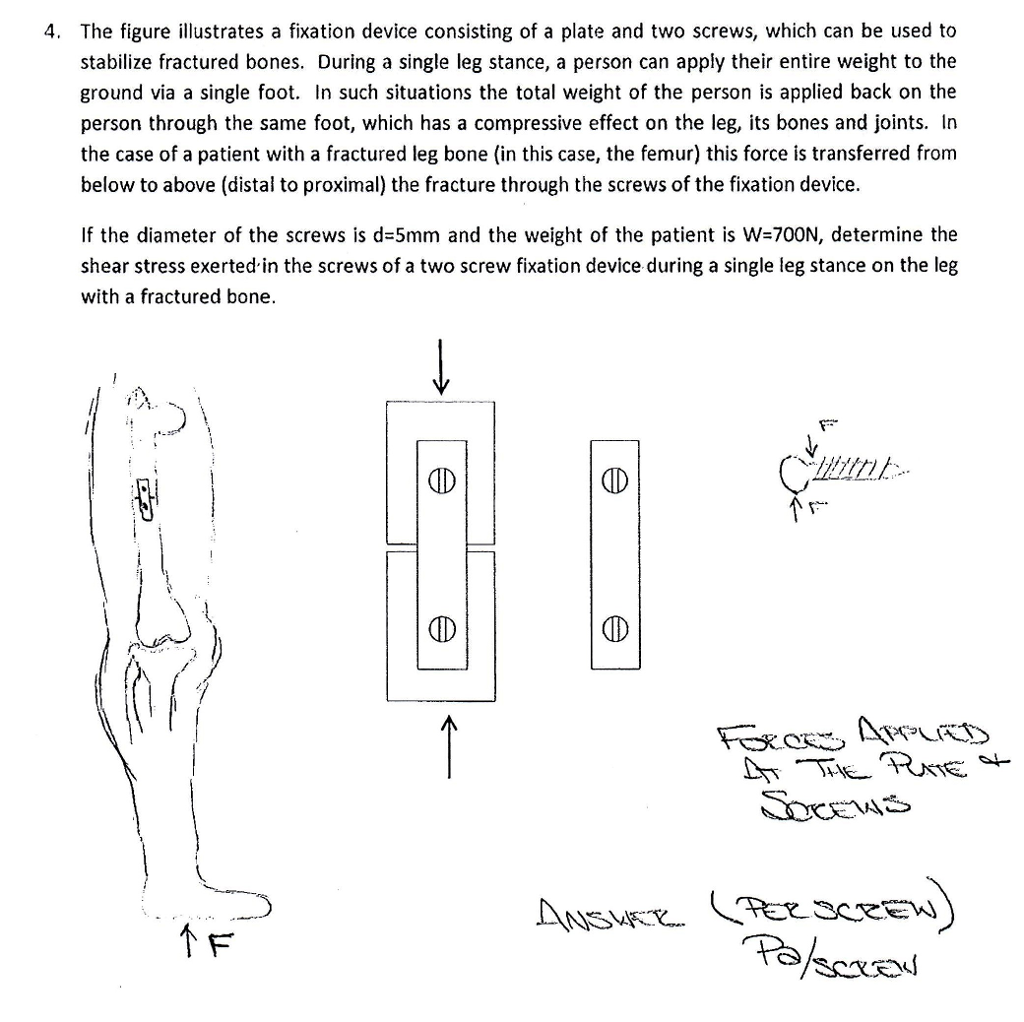 Solved 4. The figure illustrates a fixation device | Chegg.com