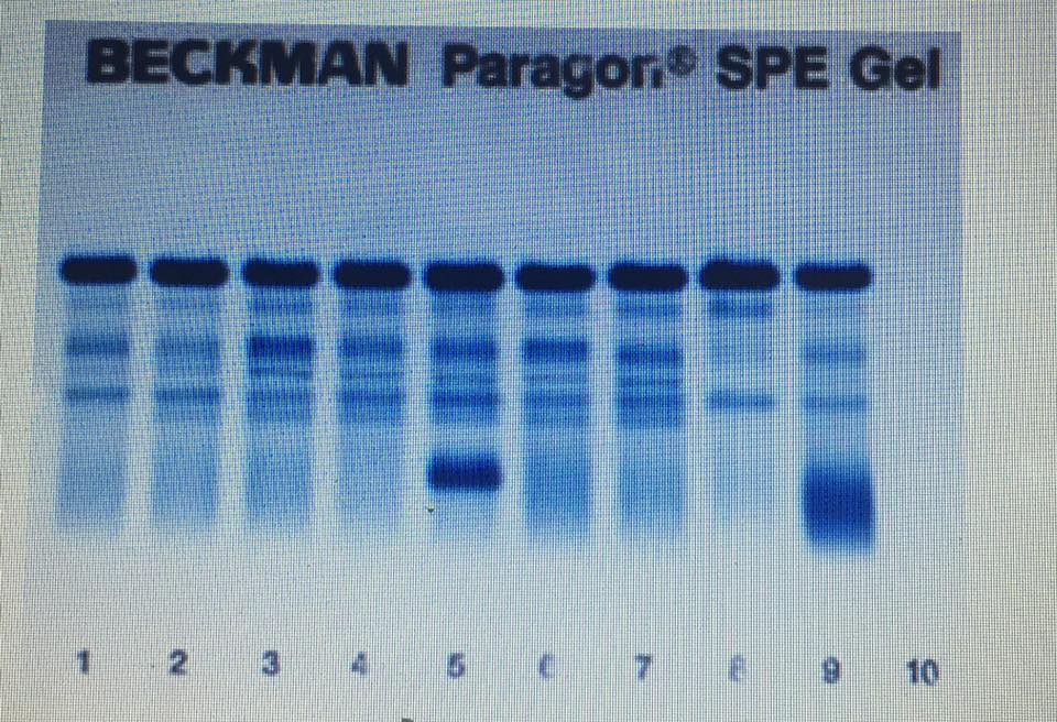 Beckman SPE Gel Case Study Help 1. On | Chegg.com