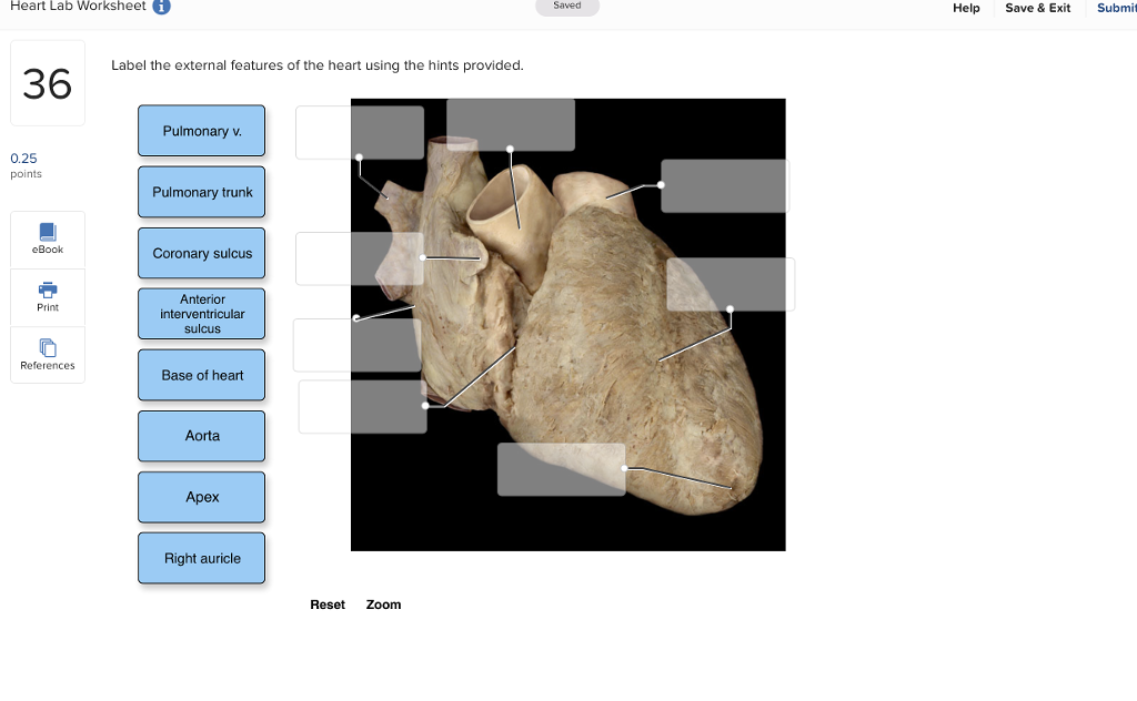 Solved Heart Lab Worksheet Saved Help Save And Exit Submit