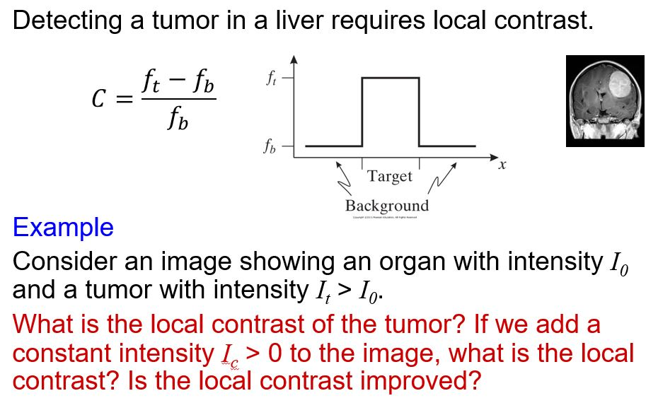 Solved Detecting a tumor in a liver requires local contrast. | Chegg.com